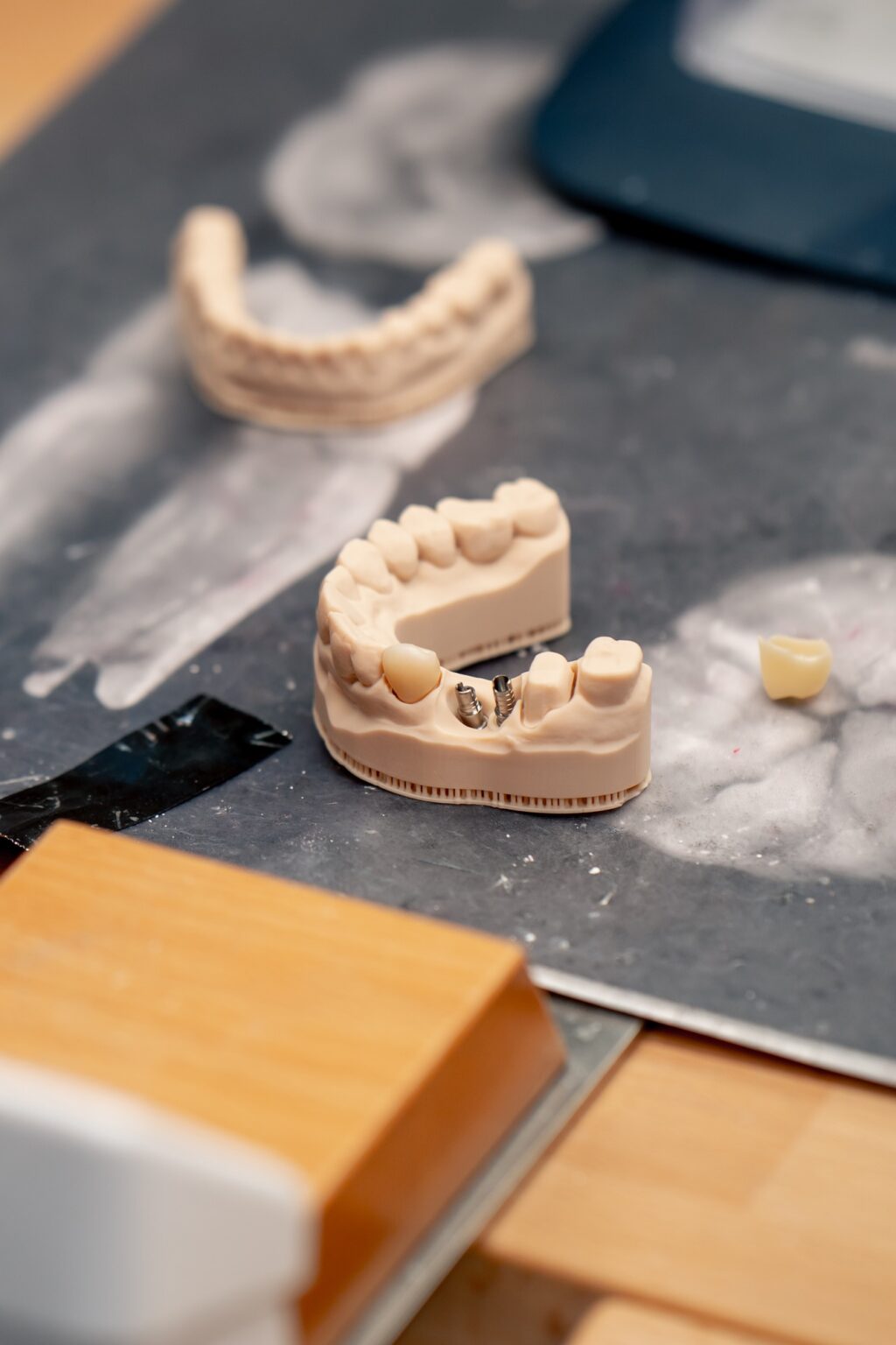Rocky Mountain Dental Laboratory | High-Quality Dental Lab in Calgary